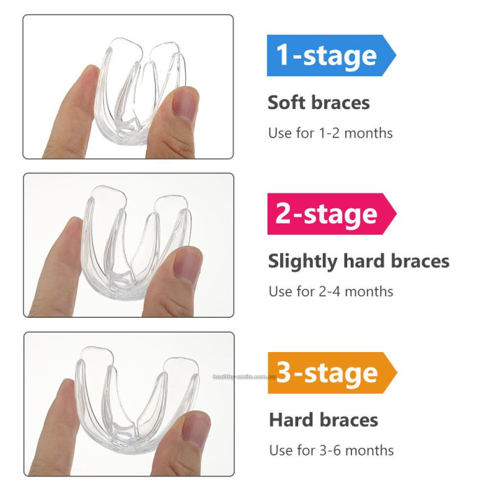 Children's teeth alignment trainer 7-13 years old, A1 (phase 1, soft)